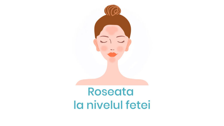 Roseata la nivelul fetei - cele mai frecvente cauze | Dr. Teodora Predescu