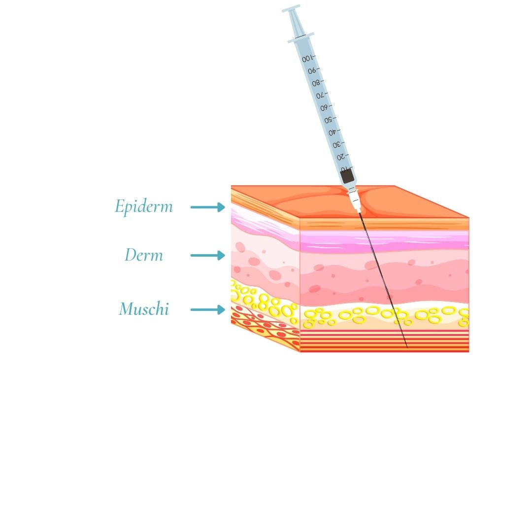 Mezobotox | Dr. Teodora Predescu | Medic dermatolog